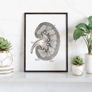 Kidney Urology Nephrology Human Anatomy Art Print Dialysis Medical ...