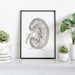 Kidney Urology Nephrology Human Anatomy Art Print Dialysis Medical ...