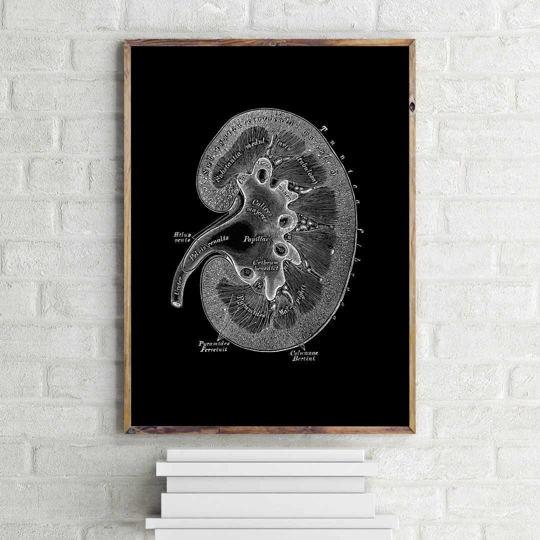 Kidney Urology Nephrology Human Anatomy Art Print Dialysis Medical ...