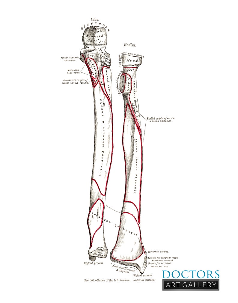 Forearm Ulna Radius Osteology Olecranon Styloid Process Vintage Human ...