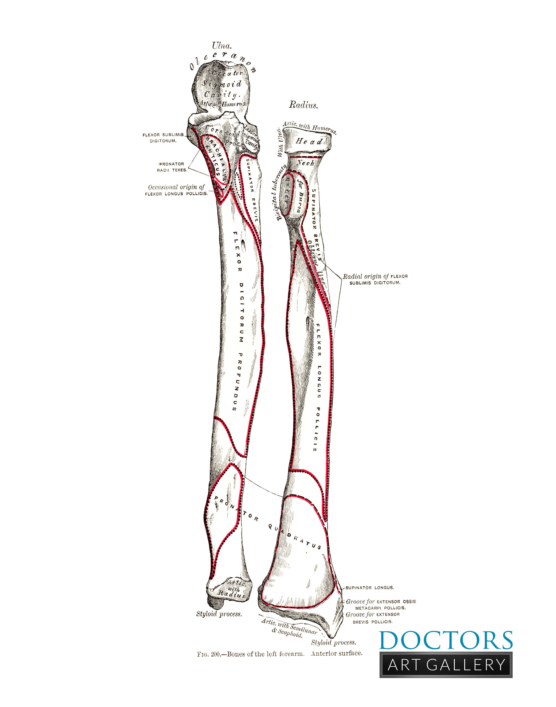 Avant-bras Radius du cubitus Ostéologie Processus styloïde de l ...