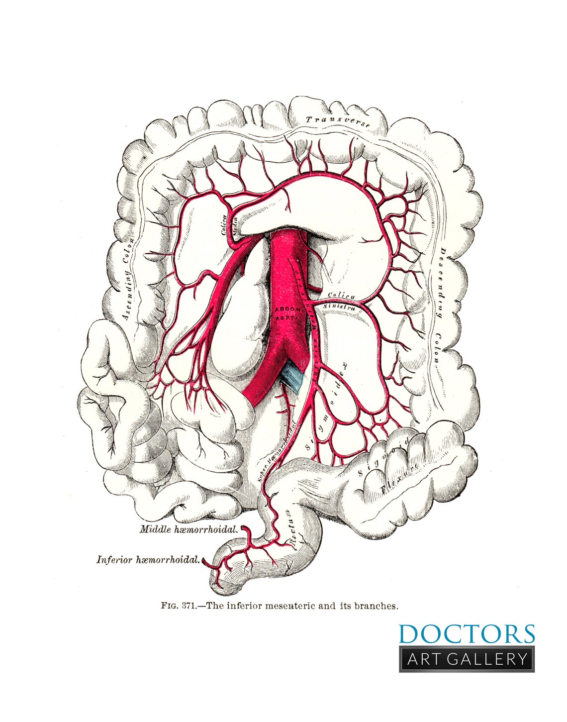 Internal Anatomy Inferior Mesenteric Artery Small Intestine Transverse ...