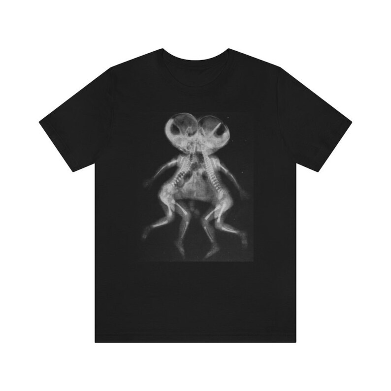 Gothic Punk Sideshow Conjoined Twin Xray Shirt - Etsy