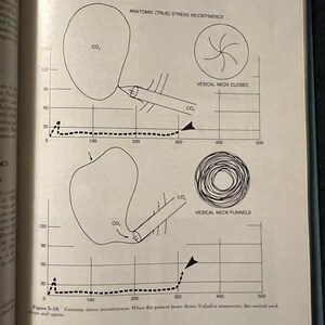 Female Urology by Shlomo Raz - Etsy