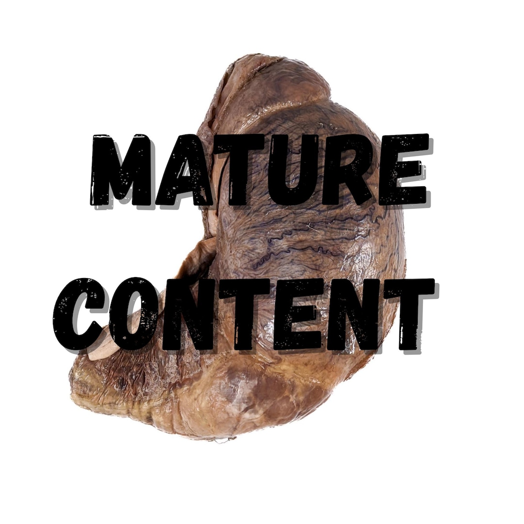 HUGE Wet Specimen Preserved Pig Testicle Display Collectible Oddities ...