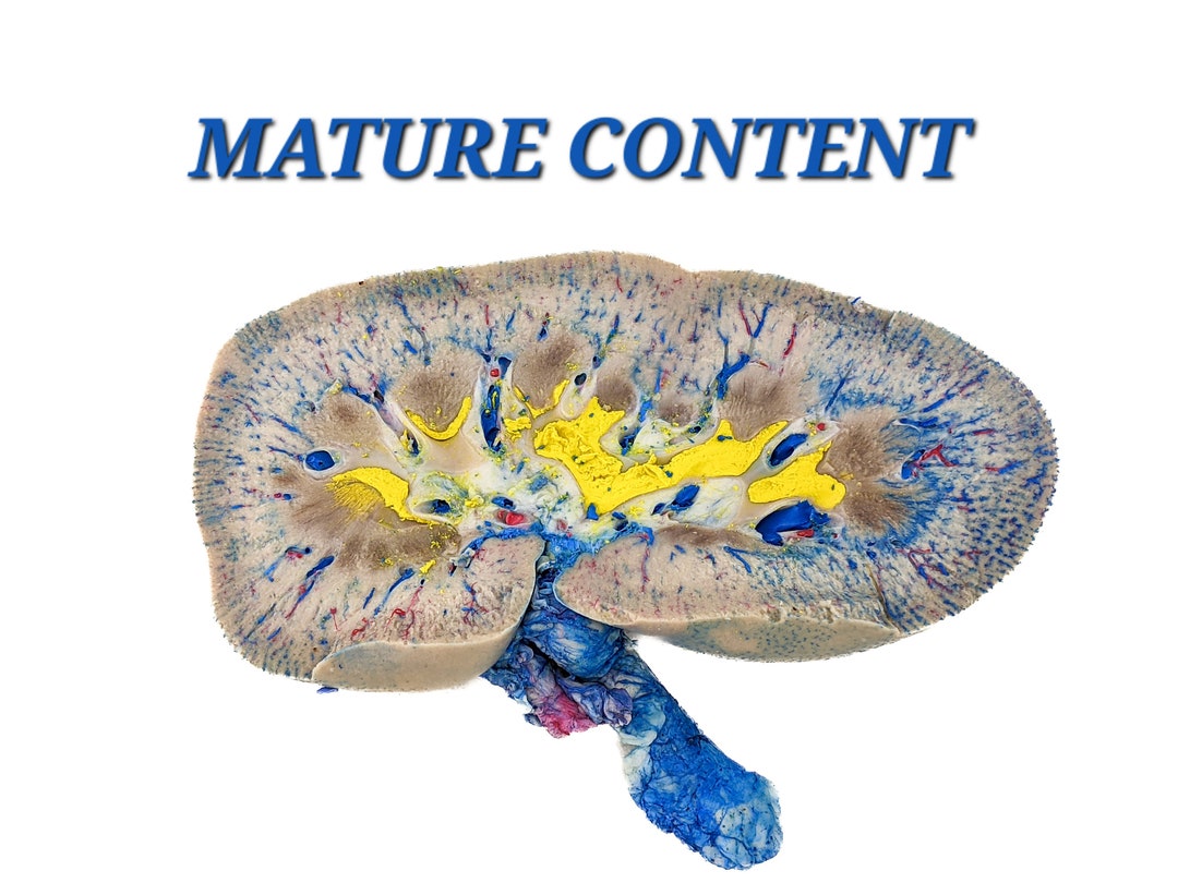 1/2 Pig Kidney 9 SALE Triple Injected Wet Specimen Preserved - Etsy