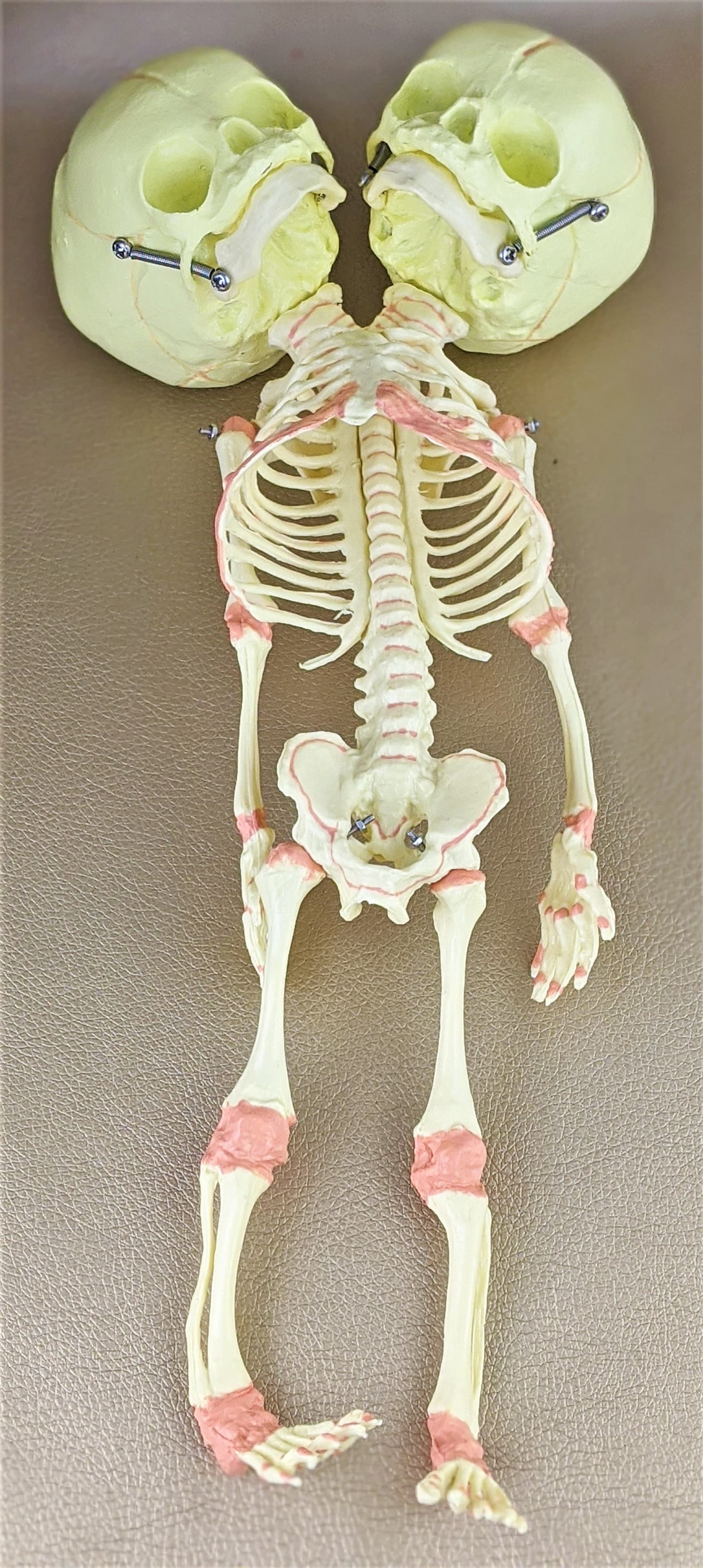 P71 Deluxe Siamese Twin Conjoined Fetus Skeleton Fetal Two - Etsy