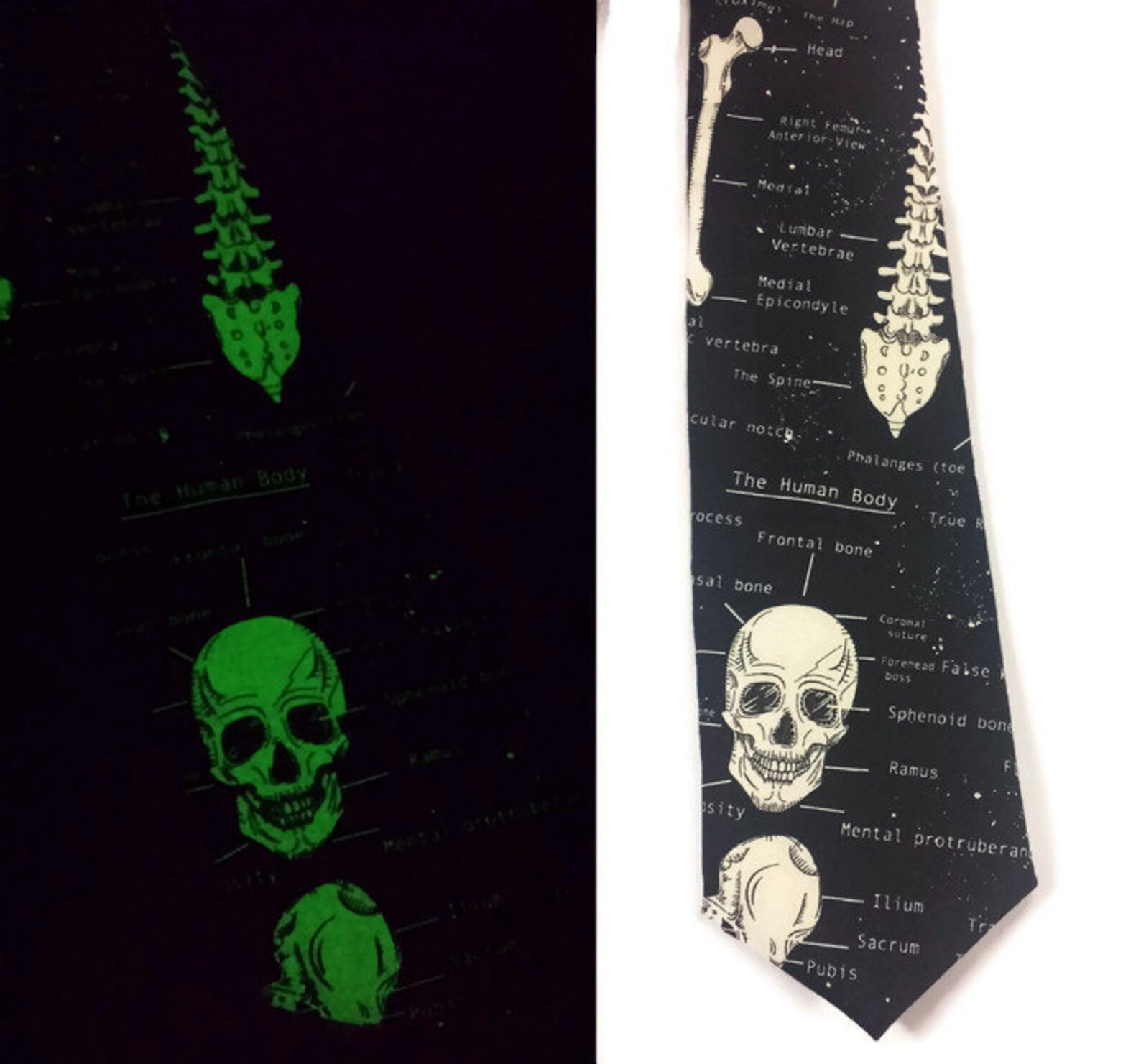 Skeleton Necktie Orthopedic Tie Chiropractic Tie Medical - Etsy