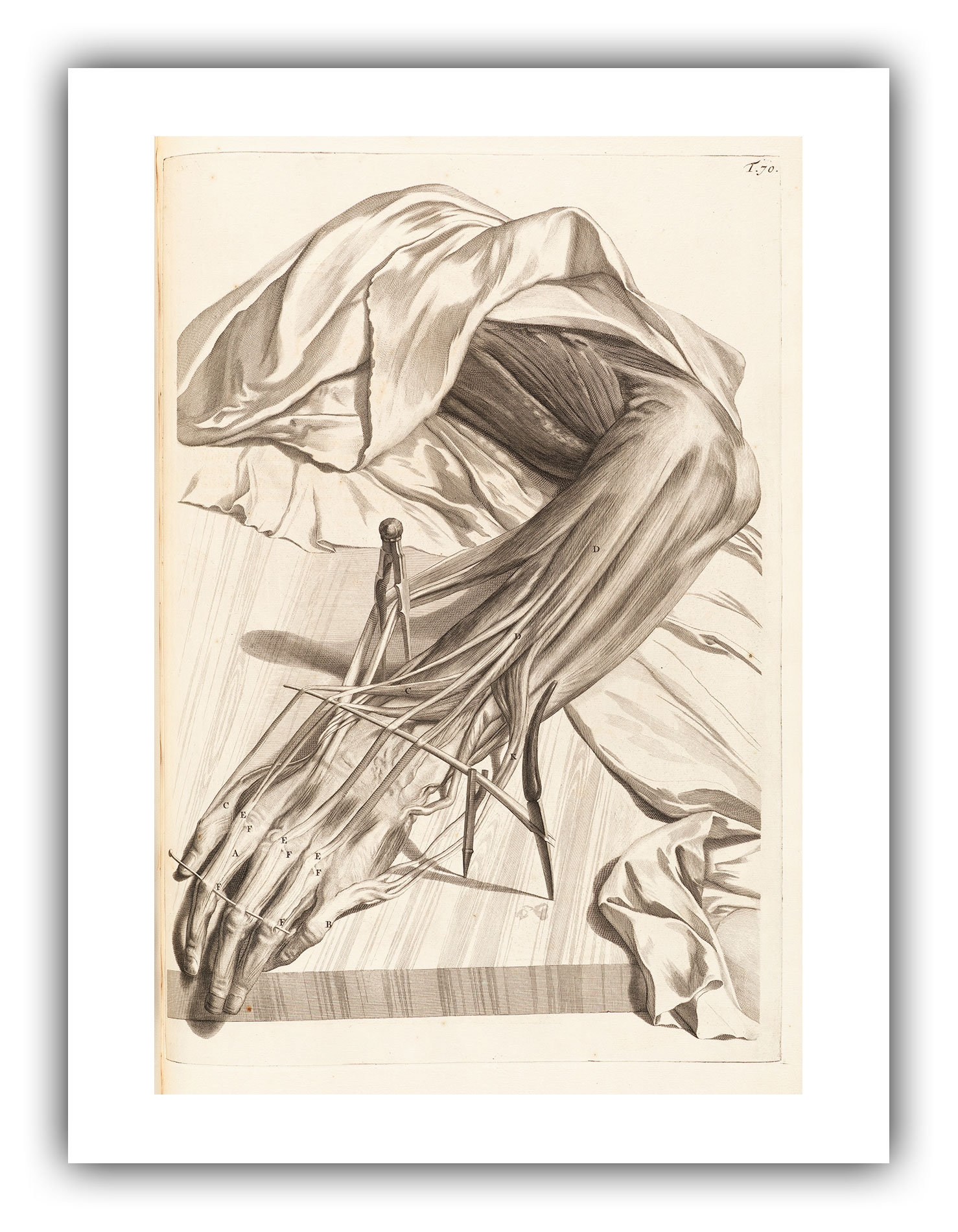 Govard Bidloo and Gerard de Laireese : Flayed Human Arm | Etsy