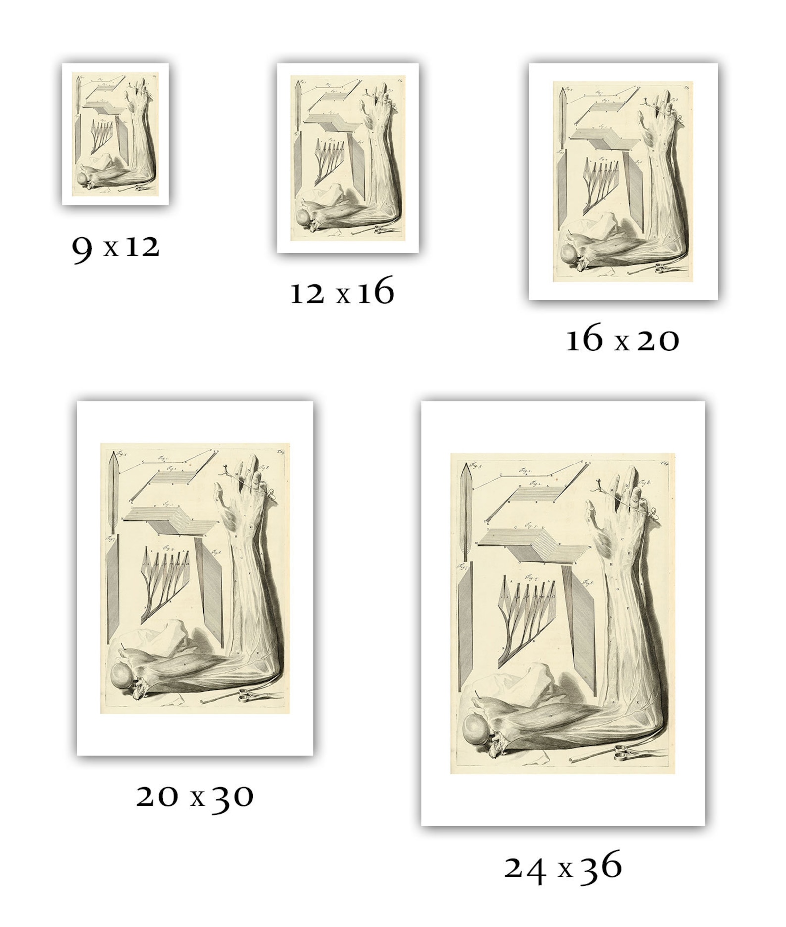 Govard Bidloo and Gerard De Laireese : Flayed Human Arm - Etsy