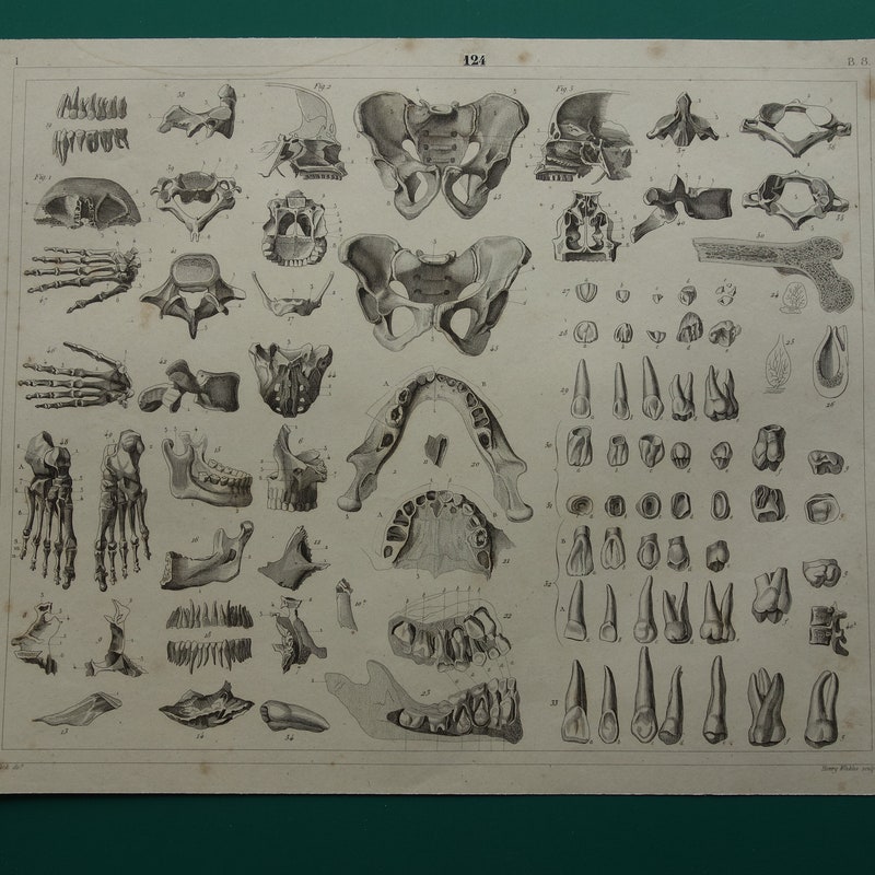 Antique Dental - Etsy