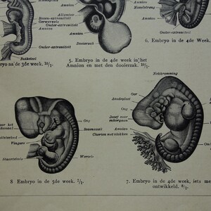 Embryo Antique Print Set of Two Anatomy Prints 1907 Old Dutch ...