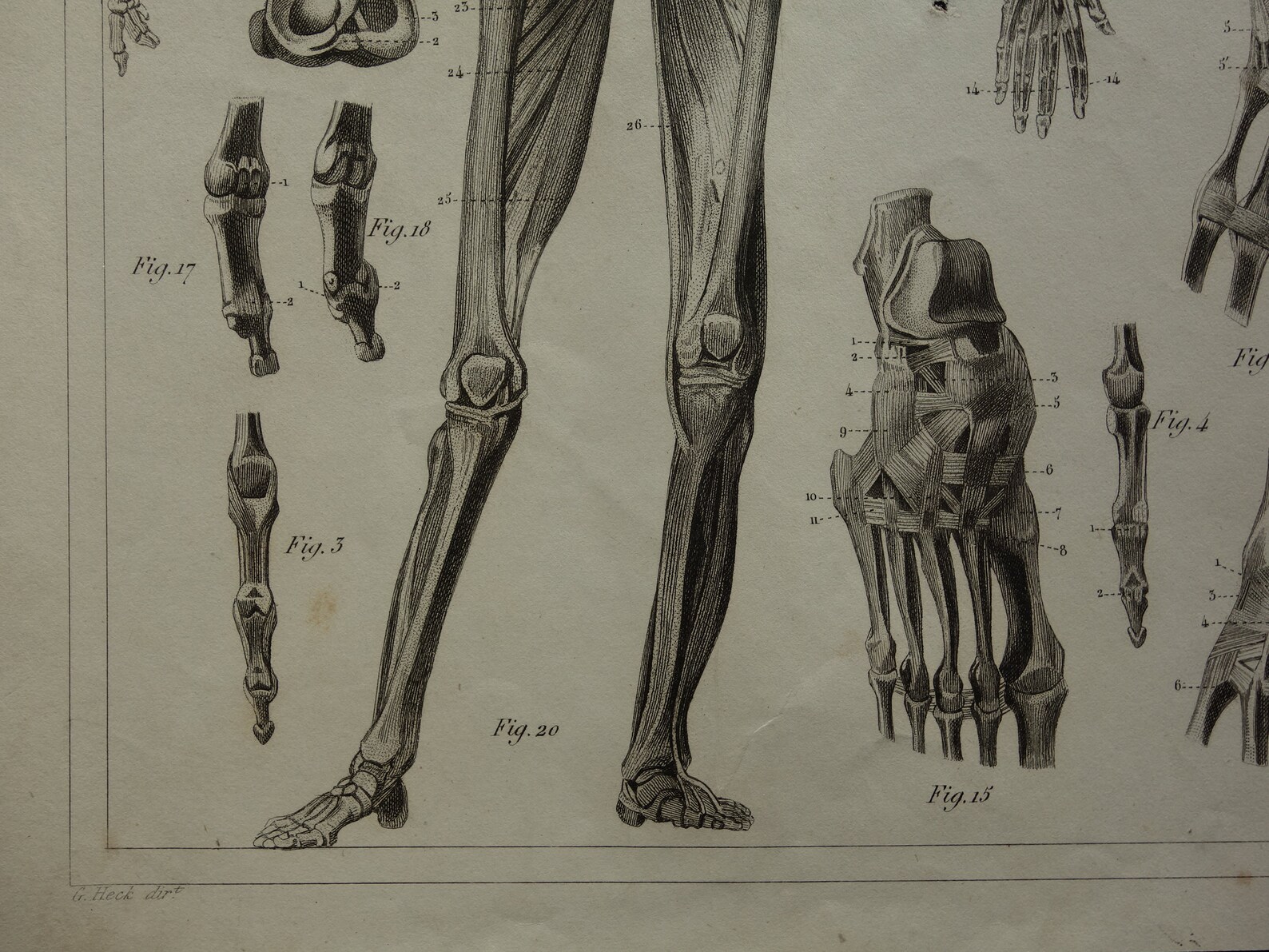 1849 Antique Anatomy Print SKELETON Original Old Anatomical - Etsy