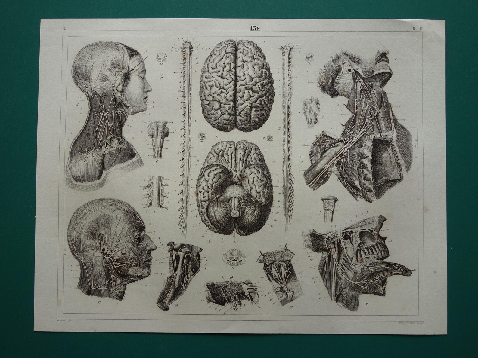 BRAIN Old Print 1849 Antique Anatomy Poster Vintage Pictures of Nervous ...