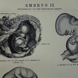 Embryo Antique Print Set of Two Anatomy Prints 1907 Old Dutch ...