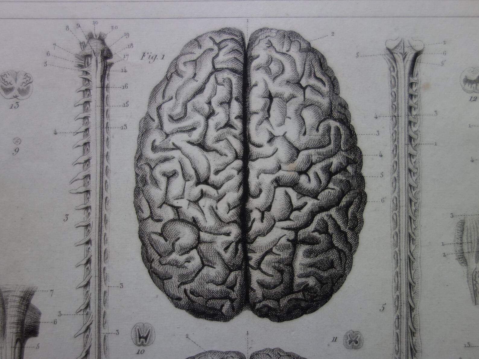BRAIN old print 1849 antique anatomy poster vintage pictures | Etsy