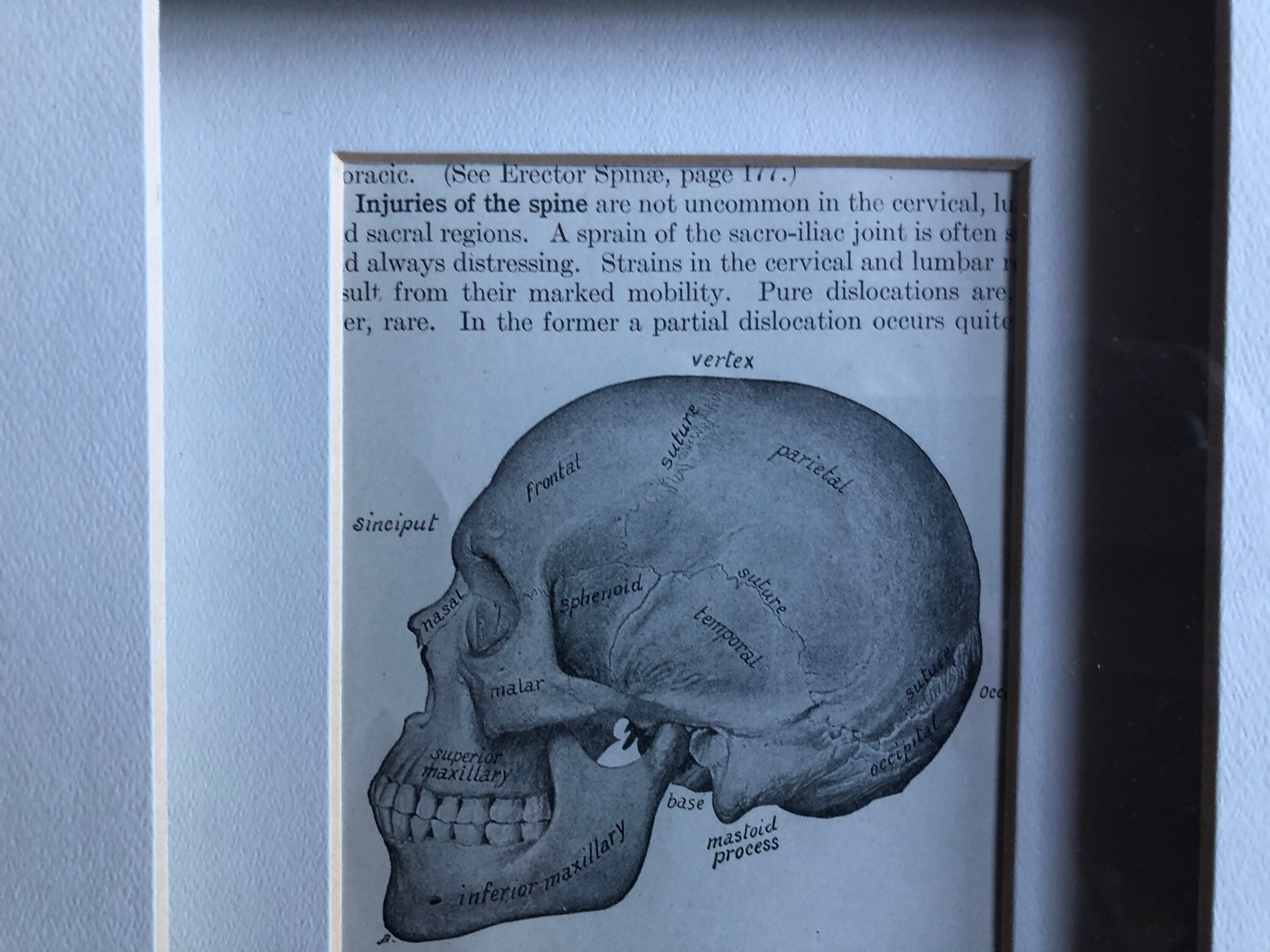 Vertex Skull
