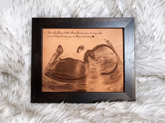 Ultrasound Baby Photo Engraving on Leather Leather - Etsy
