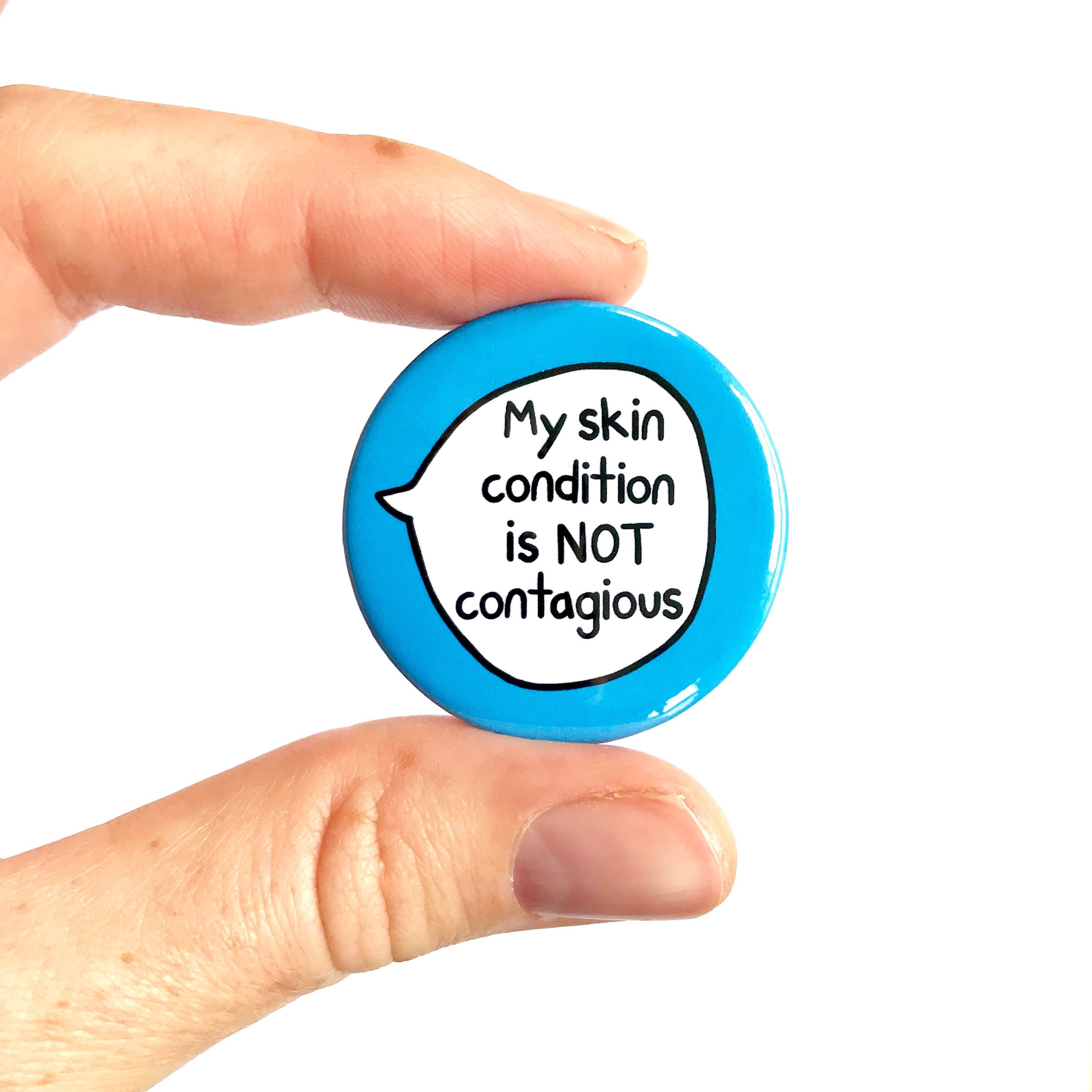 My Skin Condition is NOT Contagious Pin Badge Button - Etsy