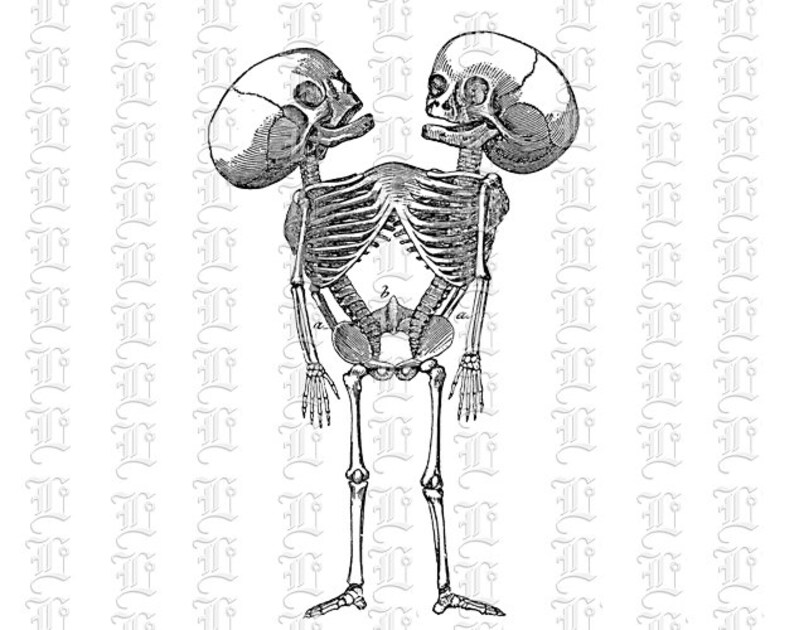 Siamese Conjoined Skeleton Twins Antique Vintage Clip Art - Etsy