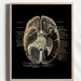 How Trauma Affects the Brain, Human Brain Poster, Brain Anatomy Poster ...