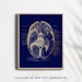 Brain Anatomy Print - Neuroscience Gift - Neurosurgeon Gift - Gold Foil ...
