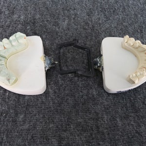Vintage Dental Teeth Mold - Etsy