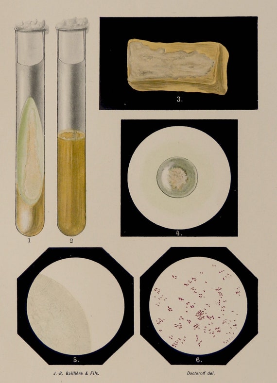 Antique Bacteriology print of bacillus Cladothrix Chromog\u00e9ne 1898 ...