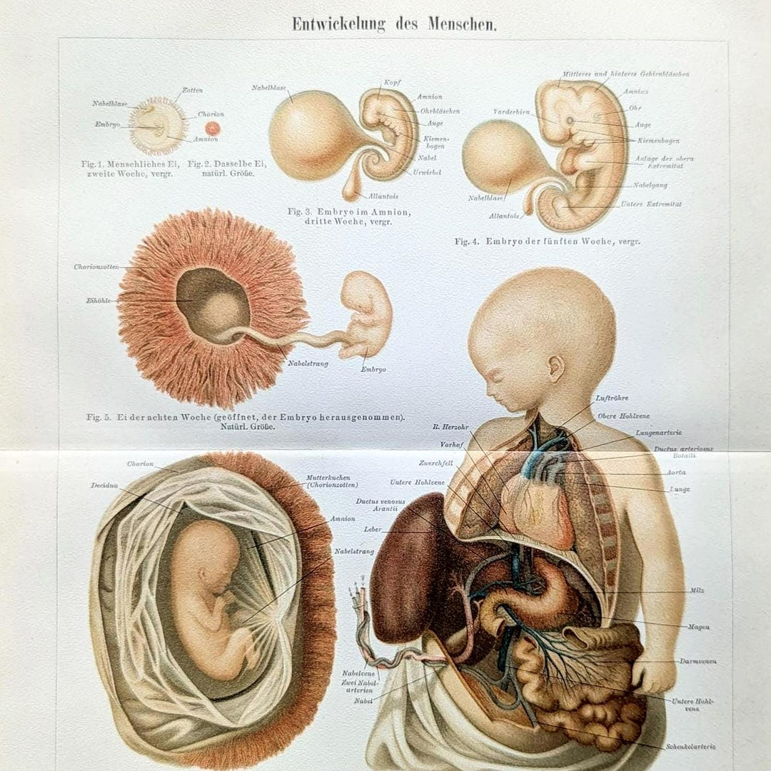 Embryo Antique Lithograph From 1893, Pregnancy, Medical Print, Original ...