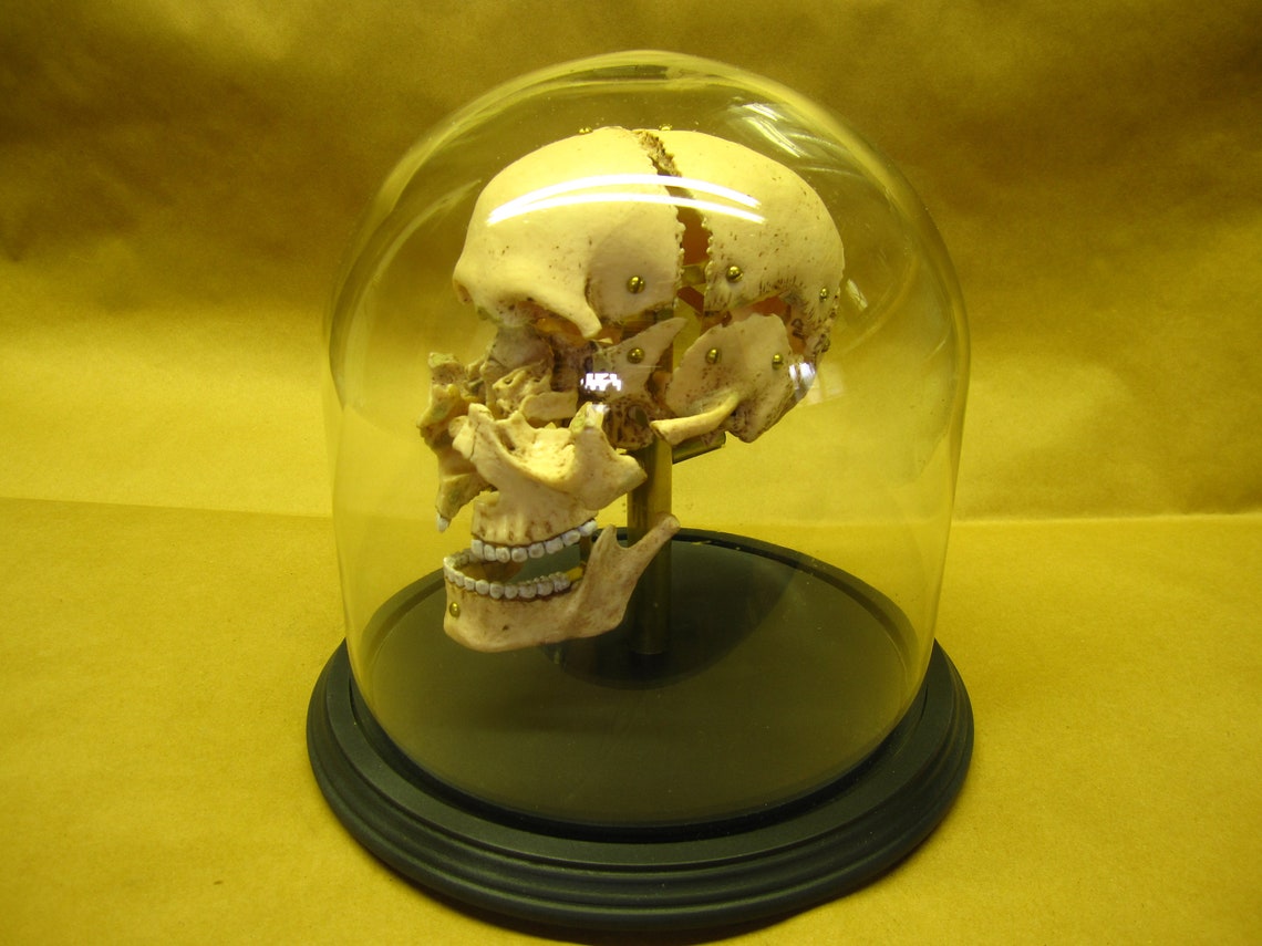 Exploded Half-size Replica Human Skull Display - Etsy