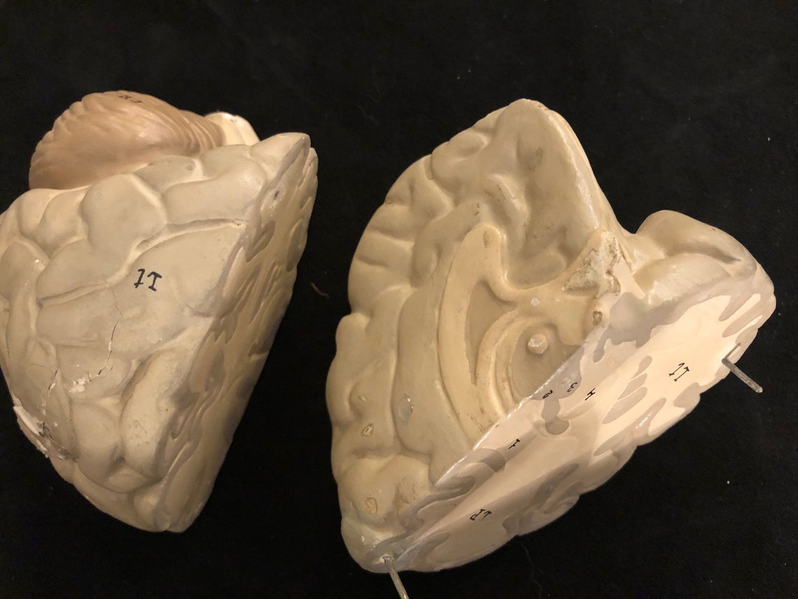 PARAVIA Human Head Section With Brain Plaster Published on - Etsy