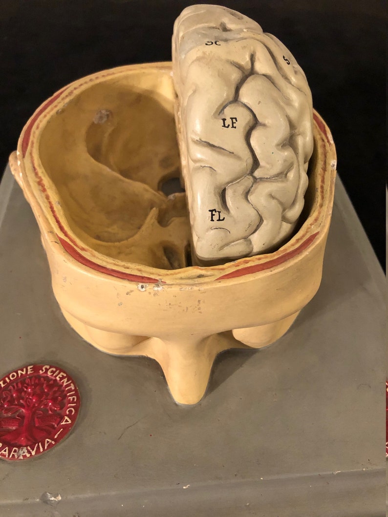 PARAVIA Human Head Section With Brain Plaster Published on - Etsy