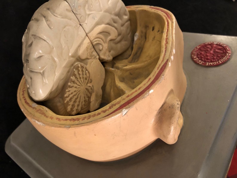 PARAVIA Human Head Section With Brain Plaster Published on - Etsy