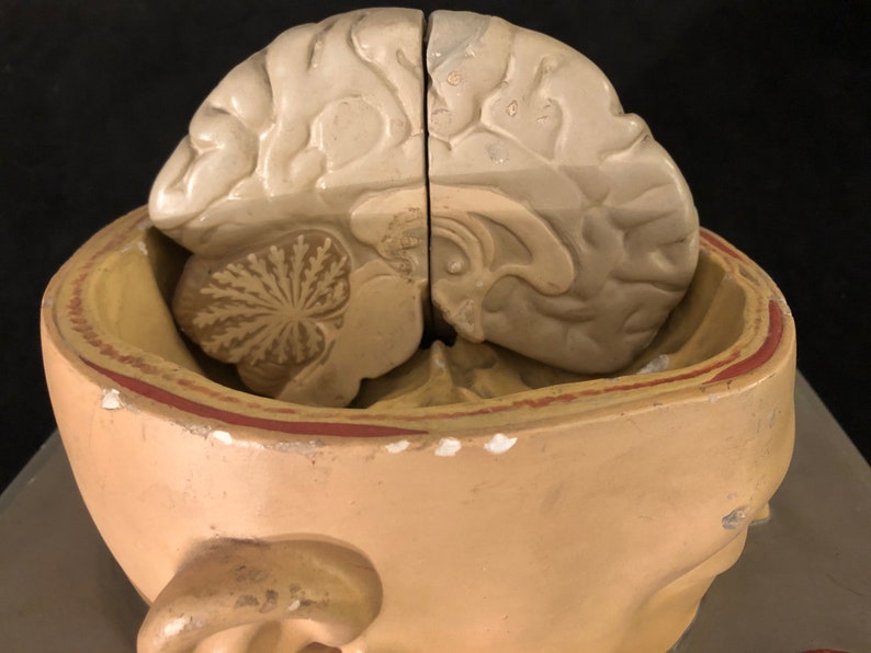 PARAVIA Human Head Section With Brain Plaster Published on - Etsy