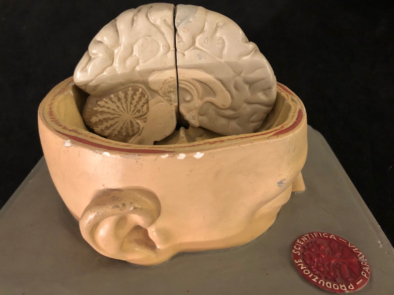 PARAVIA Human Head Section With Brain Plaster Published on - Etsy