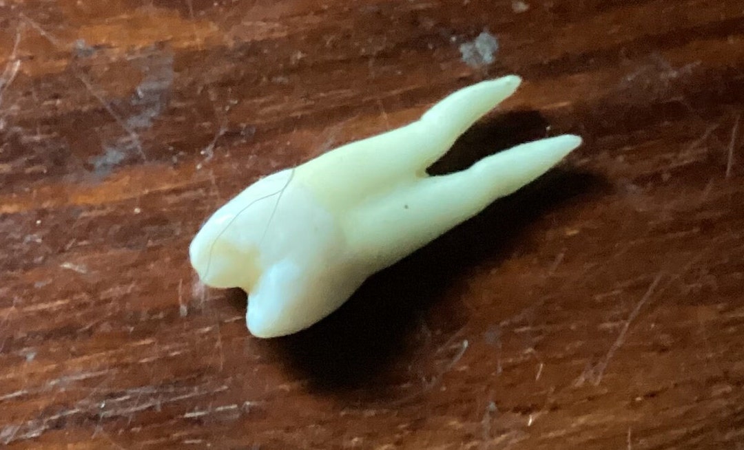 Creepy Vintage Human Tooth Specimen Extracted Lower Molar With Long ...