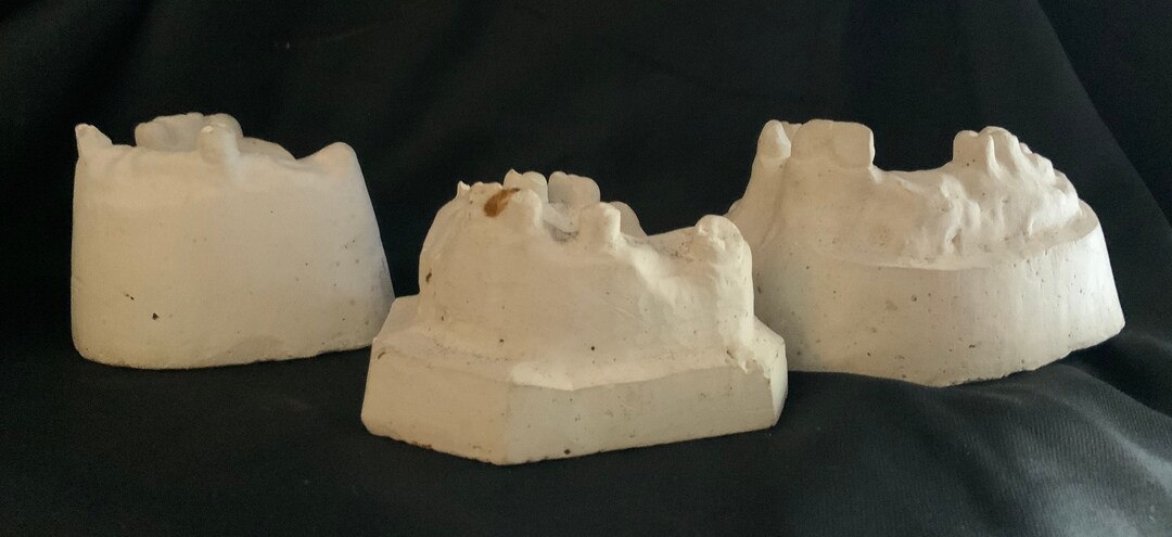 Vintage Plaster Human Tooth Casts Dentist Medical Oddity Gothic Decor ...