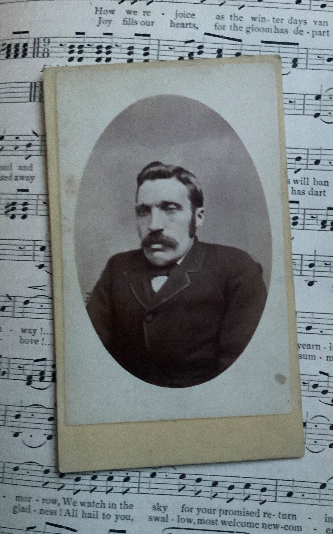 Antique Victorian CDV Photo – Man With Klippel Feil Syndrome - Etsy