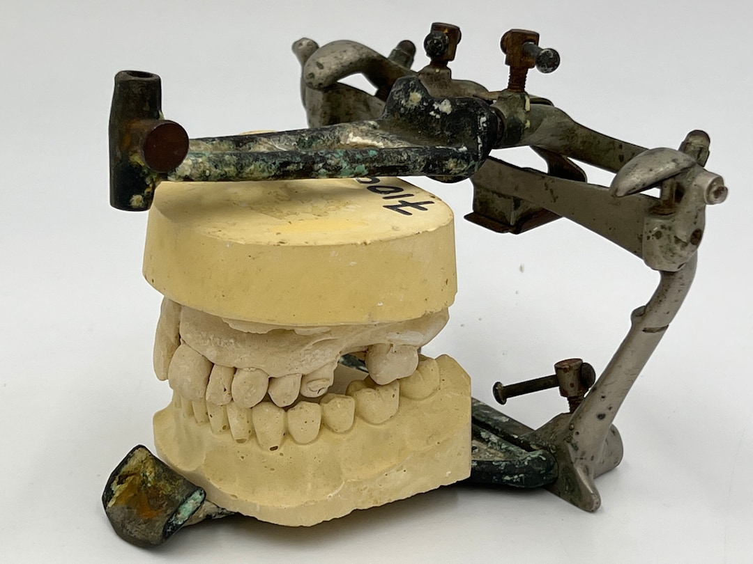 Antique Dental Articulator With Plaster Teeth Antique Dental - Etsy