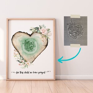 Embryo Art Custom Botanical Nursery Print - IVF Baby Girl Nursery Wall ...