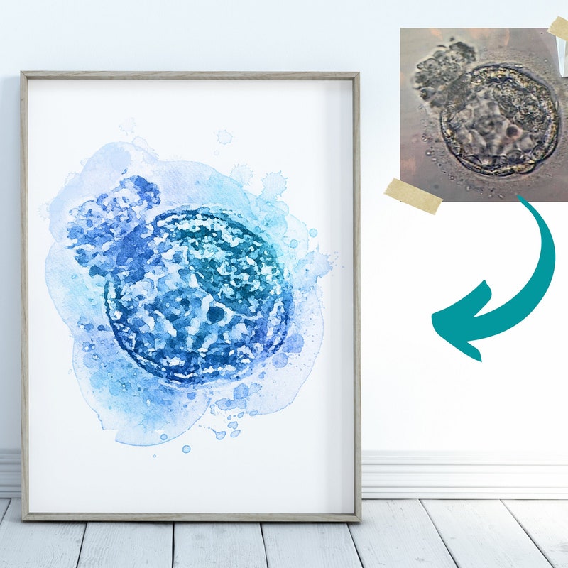 Embryo Fertility Art - Etsy