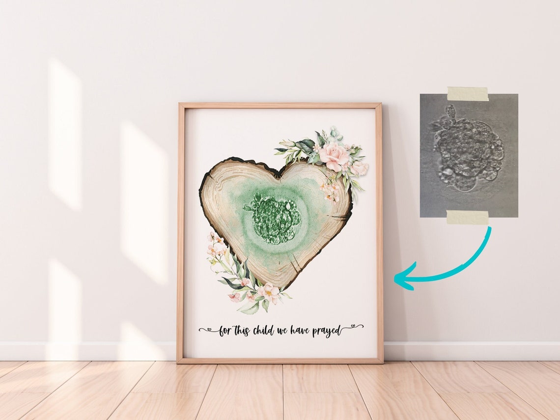 Embryo Art Custom Botanical Nursery Print IVF Baby Girl - Etsy