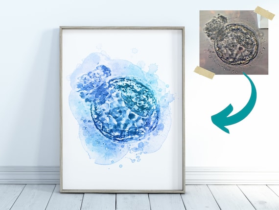 Custom IVF Art Embryo Watercolor Personalized Pregnancy Gift - Etsy ...
