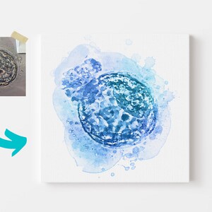 Embryo Art Custom Canvas Print IVF Baby Pregnancy Announcement IVF Art ...