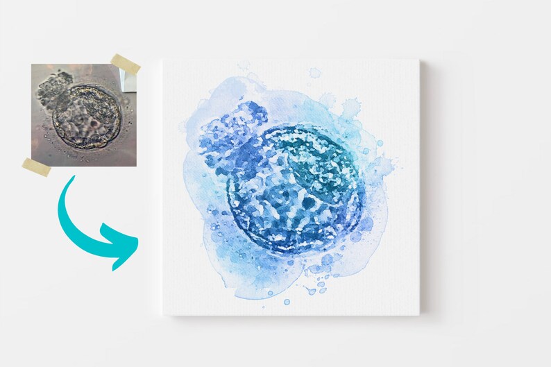Embryo Art Custom Canvas Print IVF Baby Pregnancy Announcement - Etsy