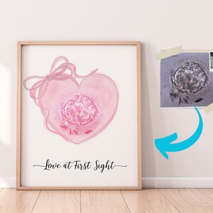 Custom Embryo Watercolor IVF Art Bow Nursery Print - Personalized IVF ...