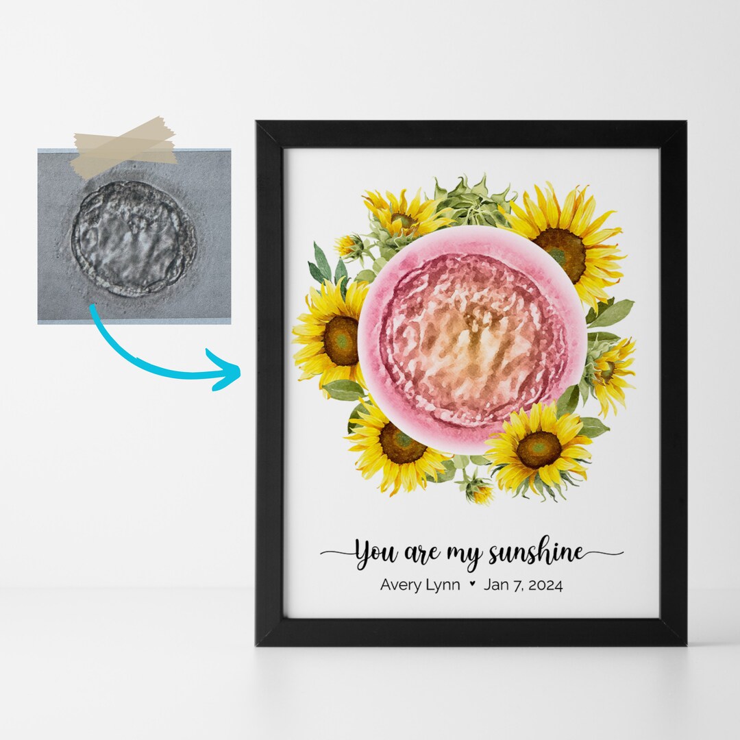 Custom Embryo Art Sunflower Nursery Embryo Watercolor Personalized ...