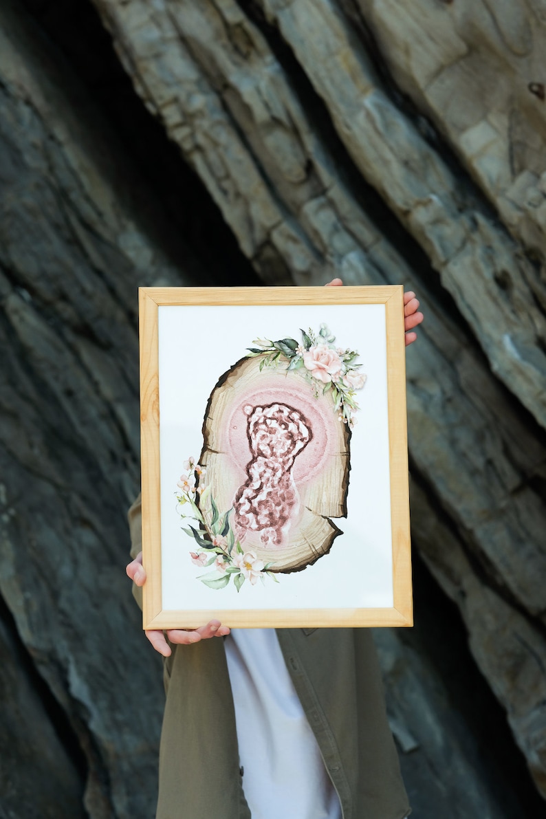 Embryo Art Custom Botanical Nursery Print - IVF Baby Girl Nursery Wall ...