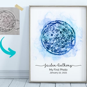 Custom IVF Art Embryo Watercolor Personalized Pregnancy Gift - Nursery ...