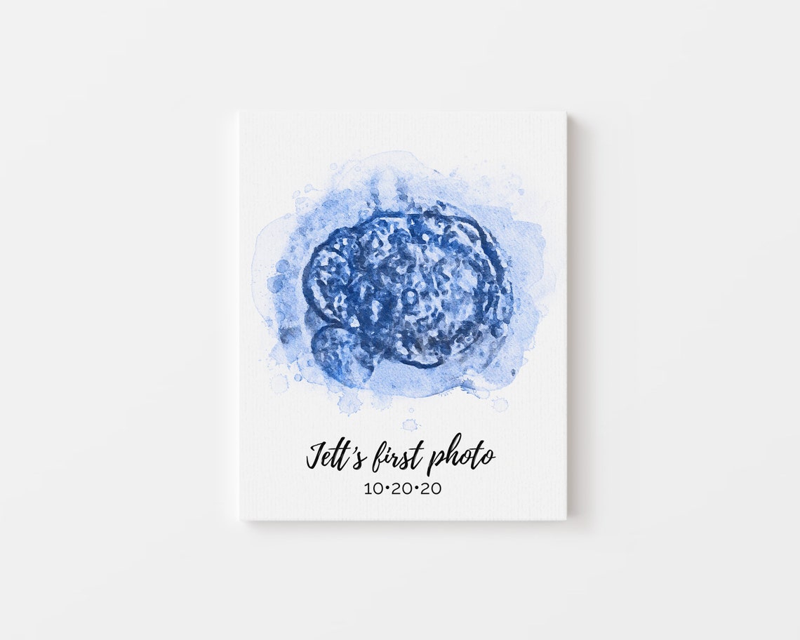 Embryo Art Custom Canvas Print IVF Baby Pregnancy Announcement - Etsy